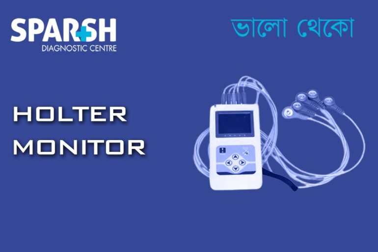 Holter Monitor - Sparsh Diagnostic Center