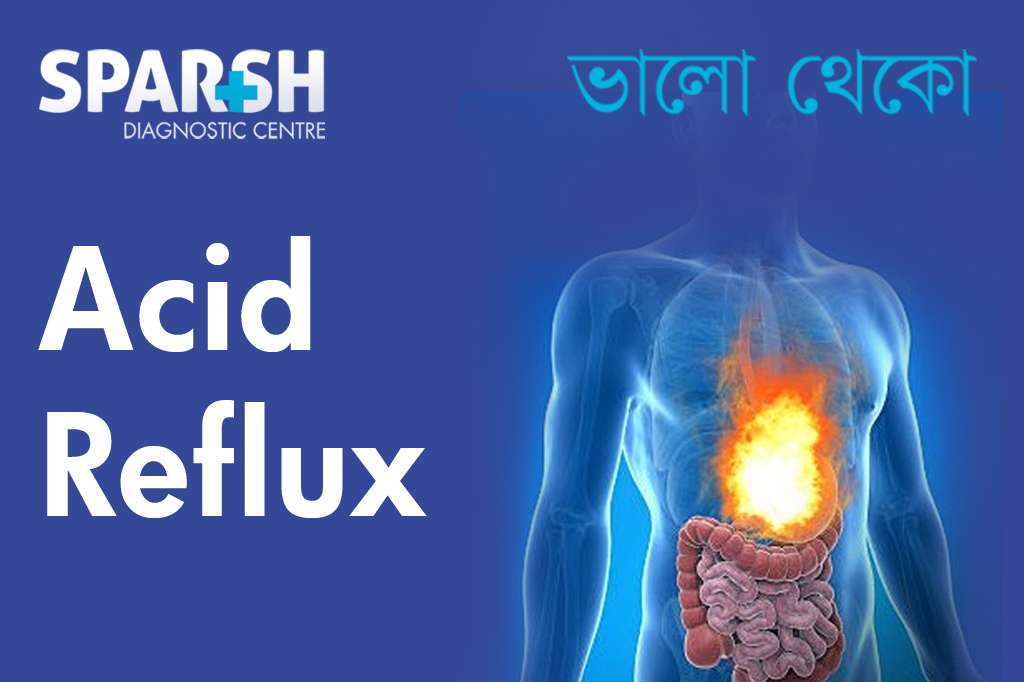 Acid Reflux Sparsh Diagnostic Center Acid Reflux Sparsh Diagnostic Center