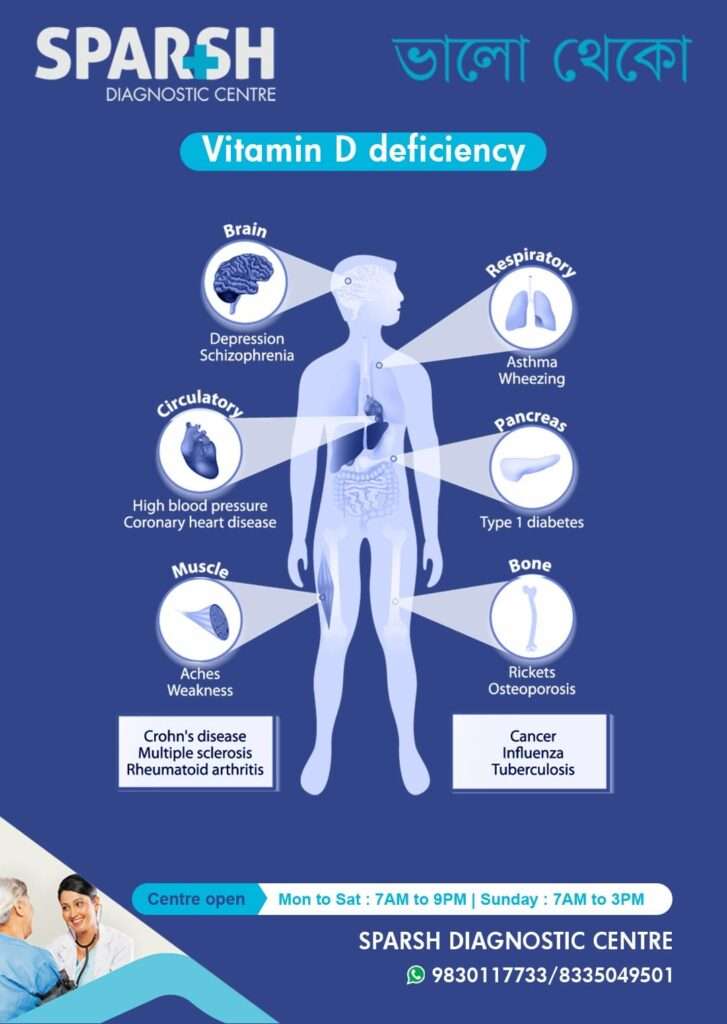 Vitamin D deficiency - Sparsh Diagnostic Center