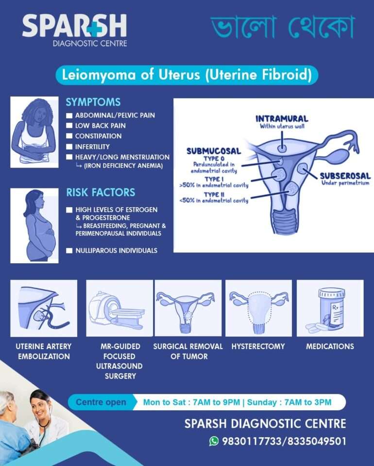 Uterine fibroids - Sparsh Diagnostic Center