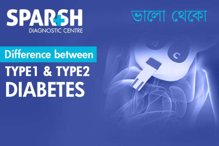 Difference between Type 1 and Type 2 diabetes - Sparsh Diagnostic Center