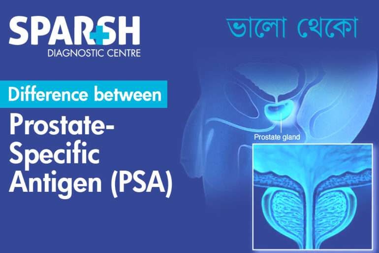 Understanding Prostate-Specific Antigen (PSA) - Sparsh Diagnostic Center