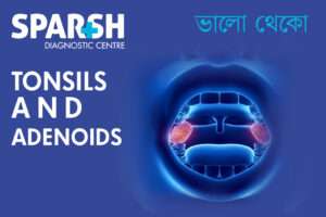 Tonsils and Adenoids - Sparsh Diagnostic Center