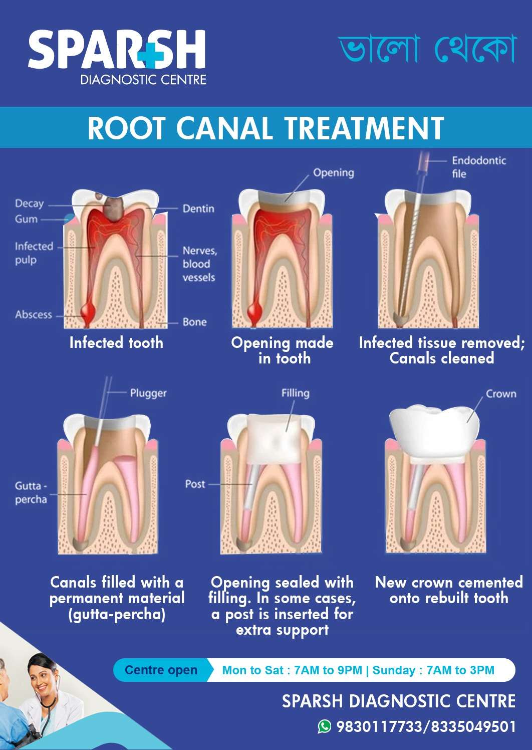 Root Canal Treatment - Sparsh Diagnostic Center