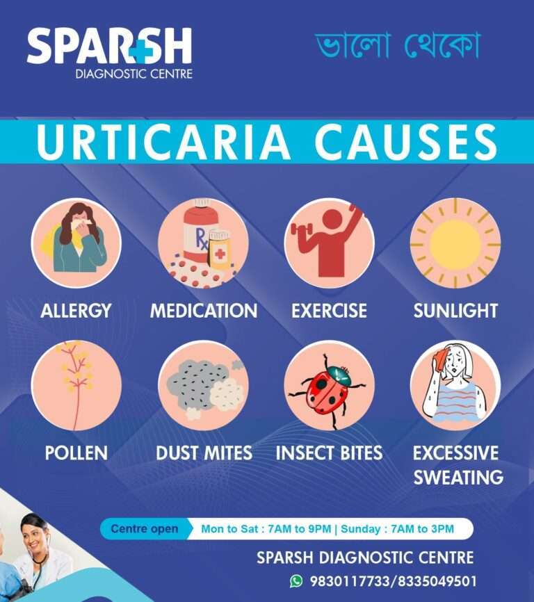 Understanding Urticaria - Sparsh Diagnostic Center