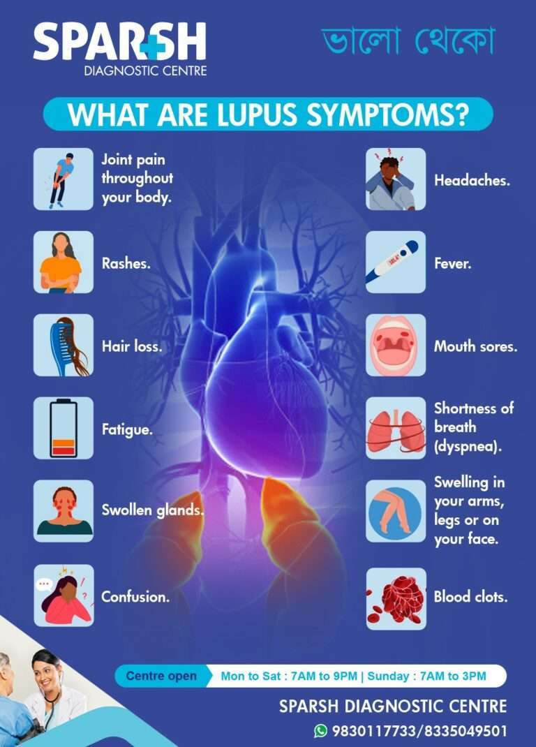 Lupus - Sparsh Diagnostic Center