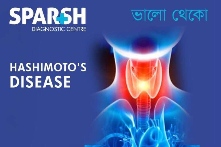 Hashimoto's disease - Sparsh Diagnostic Center