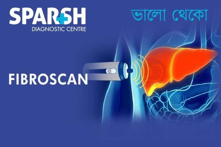 FibroScan - Sparsh Diagnostic Center