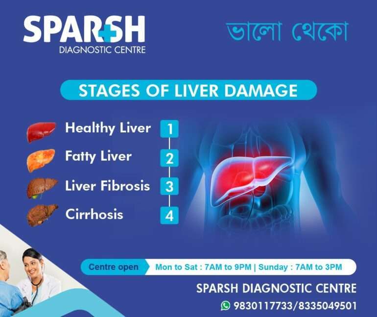Stages of Liver Damage - Sparsh Diagnostic Center