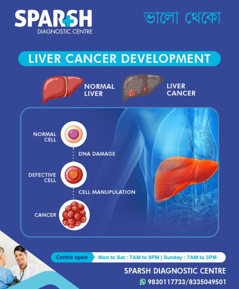 Liver Cancer - Sparsh Diagnostic Center