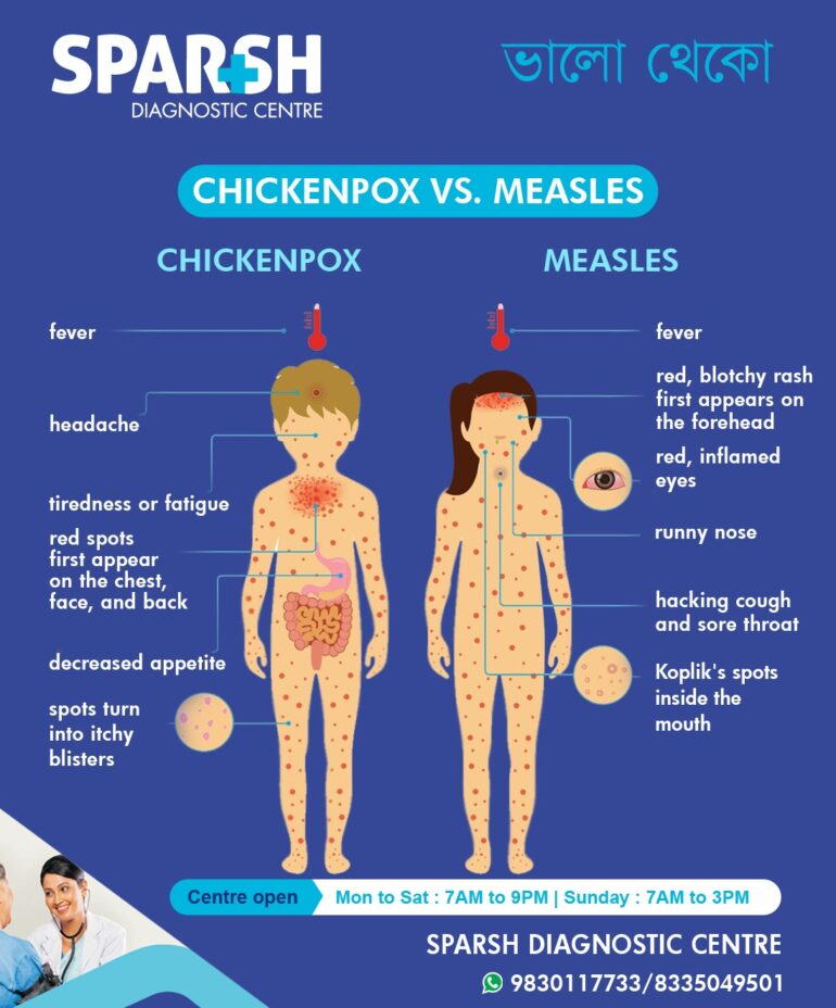Measles and chickenpox: How are they different? - Sparsh Diagnostic Center