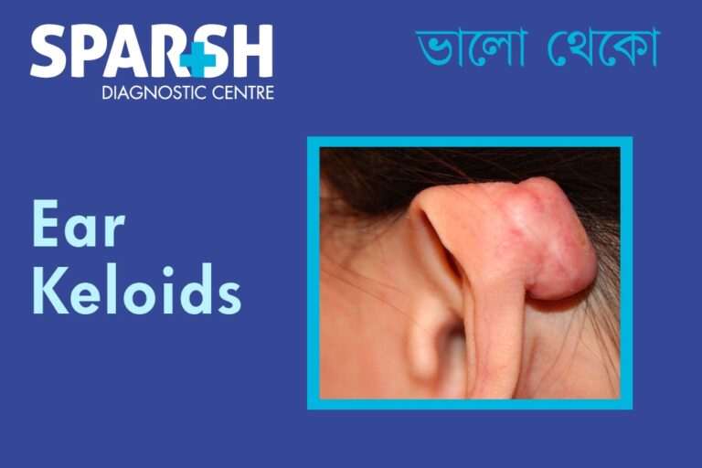 Ear Keloids - Sparsh Diagnostic Center