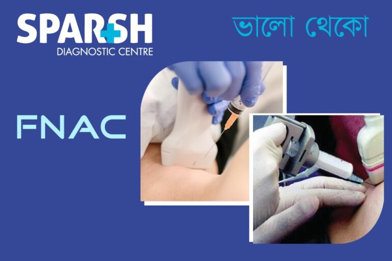 Fine Needle Aspiration Cytology (FNAC) - Sparsh Diagnostic Center