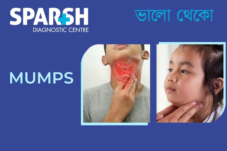 Mumps - Sparsh Diagnostic Center