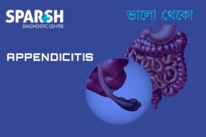 Appendicitis - Sparsh Diagnostic Center