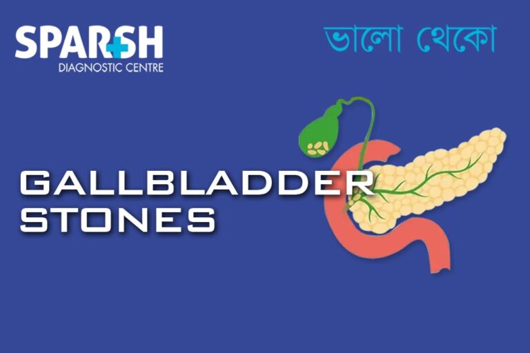Gallbladder Stones - Sparsh Diagnostic Center
