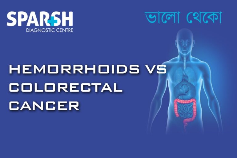 Hemorrhoids vs. Colorectal Cancer: Understanding the Differences ...