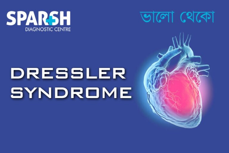Dressler syndrome - Sparsh Diagnostic Center