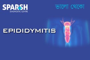 Epididymitis - Sparsh Diagnostic Center