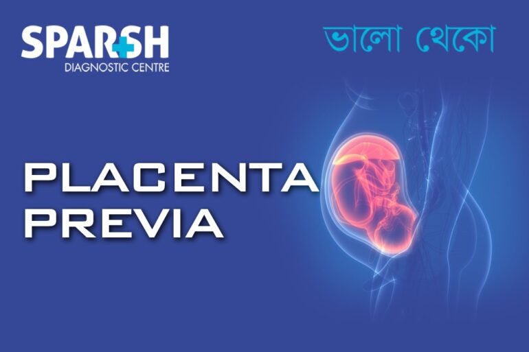 Placenta Previa - Sparsh Diagnostic Center