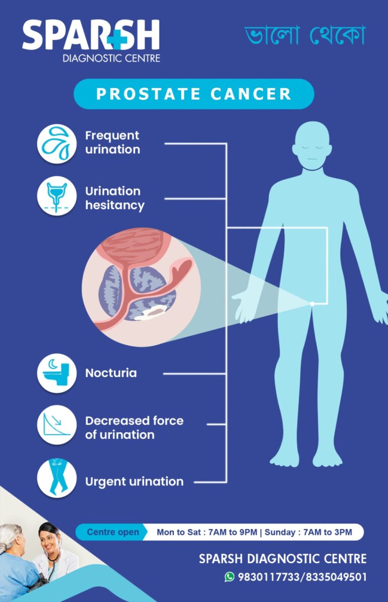 Prostate Cancer: What Every Man Should Know - Sparsh Diagnostic Center