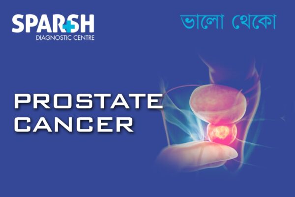 Prostate Cancer: What Every Man Should Know - Sparsh Diagnostic Center