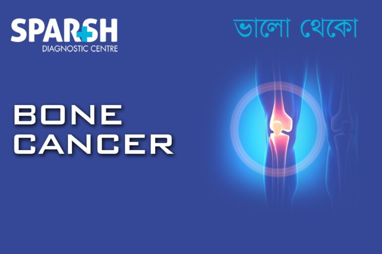 Bone Cancer - Sparsh Diagnostic Center