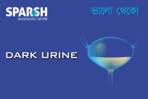 Dark Urine - Sparsh Diagnostic Center