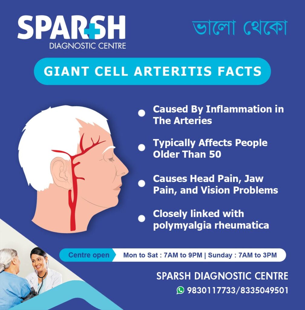 Giant Cell Arteritis - Sparsh Diagnostic Center