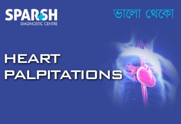 Heart Palpitations - Sparsh Diagnostic Center