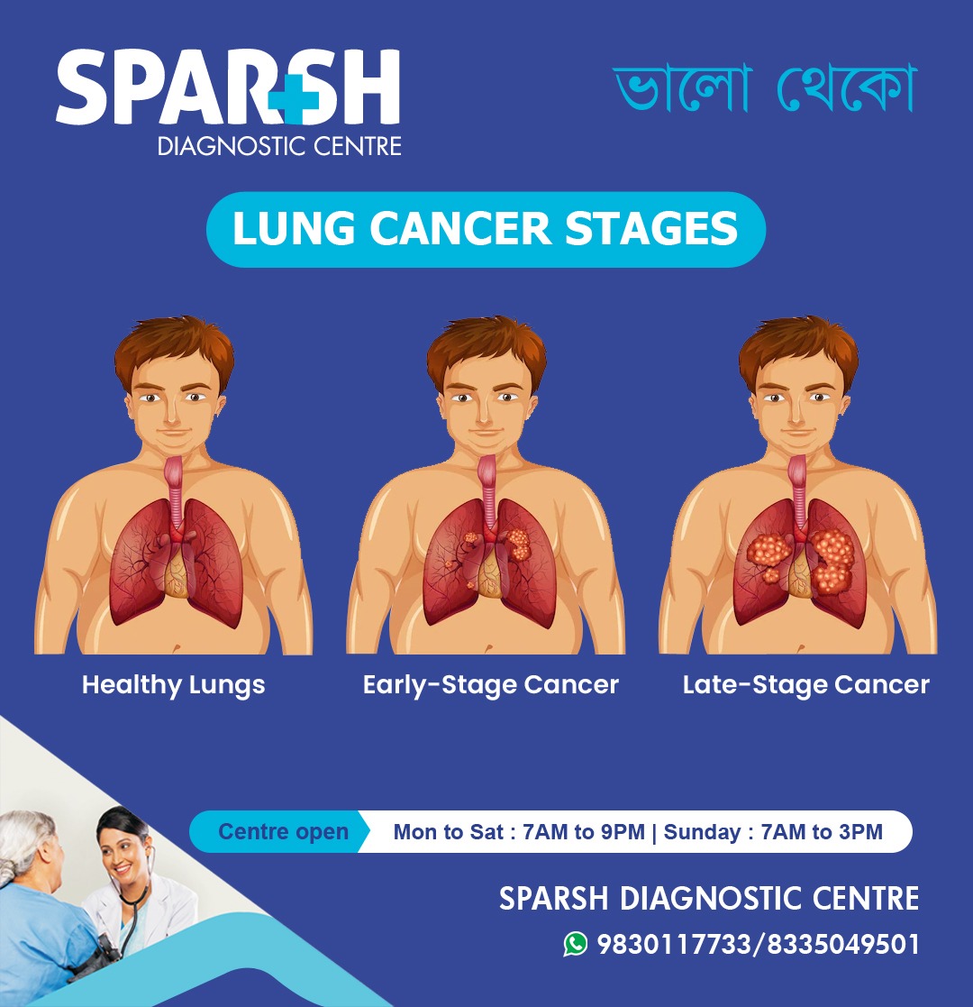 Lung Cancer - Sparsh Diagnostic Center