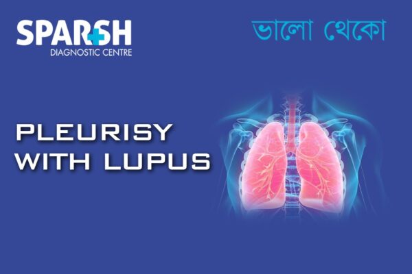 Pleurisy with Lupus - Sparsh Diagnostic Center