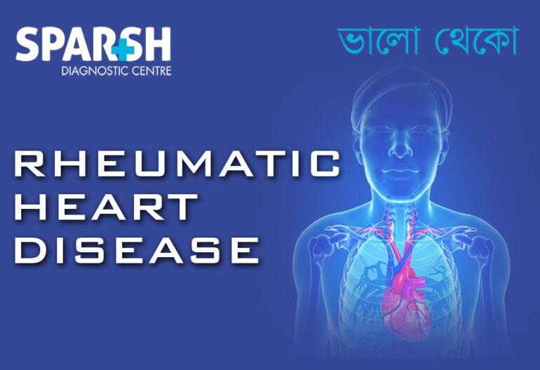 Rheumatic Heart Disease - Sparsh Diagnostic Center