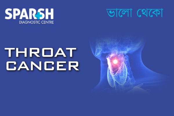 Throat Cancer - Sparsh Diagnostic Center