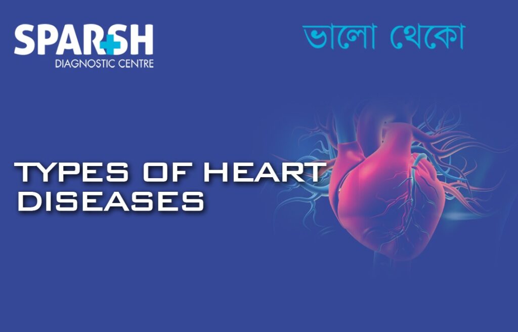 Types of Heart Diseases - Sparsh Diagnostic Center