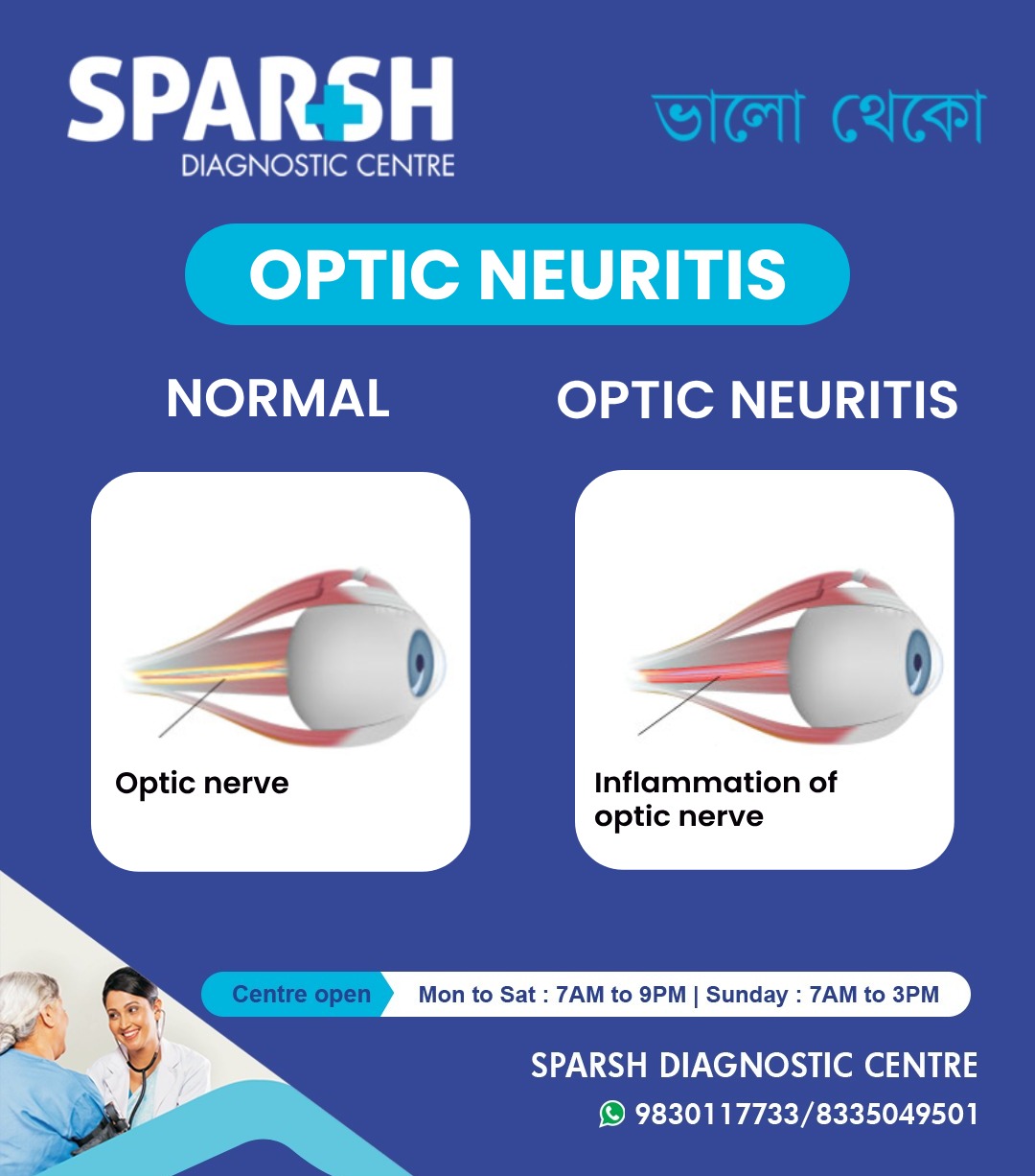 Optic Neuritis - Sparsh Diagnostic Center