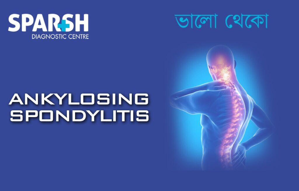 Understanding Ankylosing Spondylitis: Symptoms, Causes, Treatment, and Living with AS - Sparsh ...