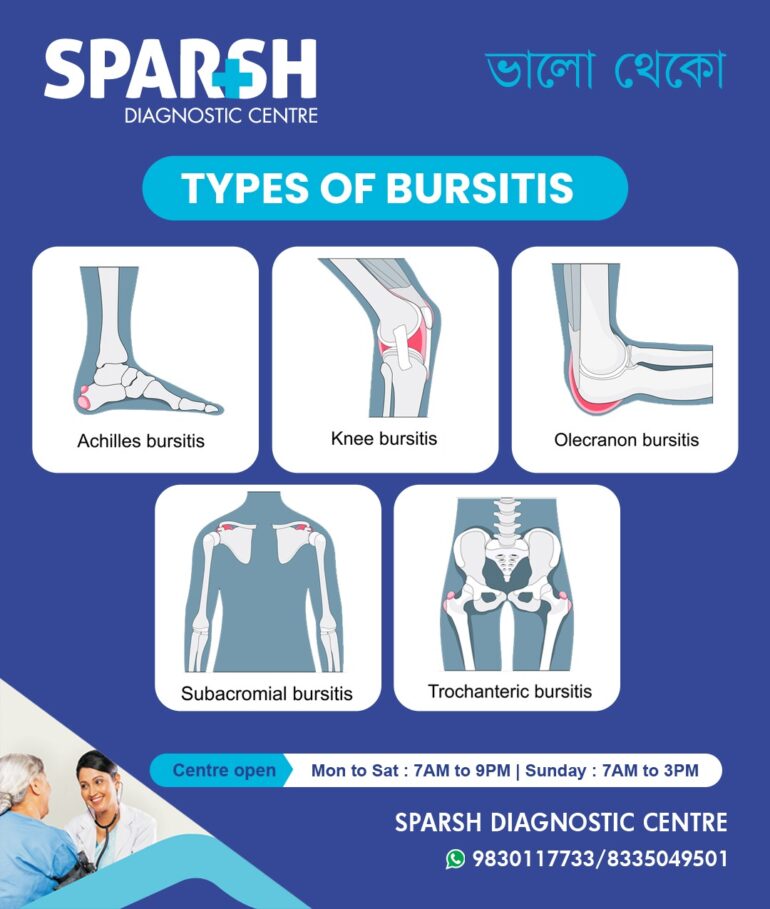 Bursitis - Sparsh Diagnostic Center