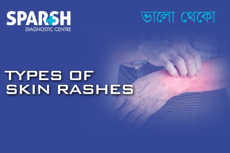 Understanding Common Types of Skin Rashes - Sparsh Diagnostic Center