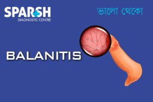 Balanitis - Sparsh Diagnostic Center