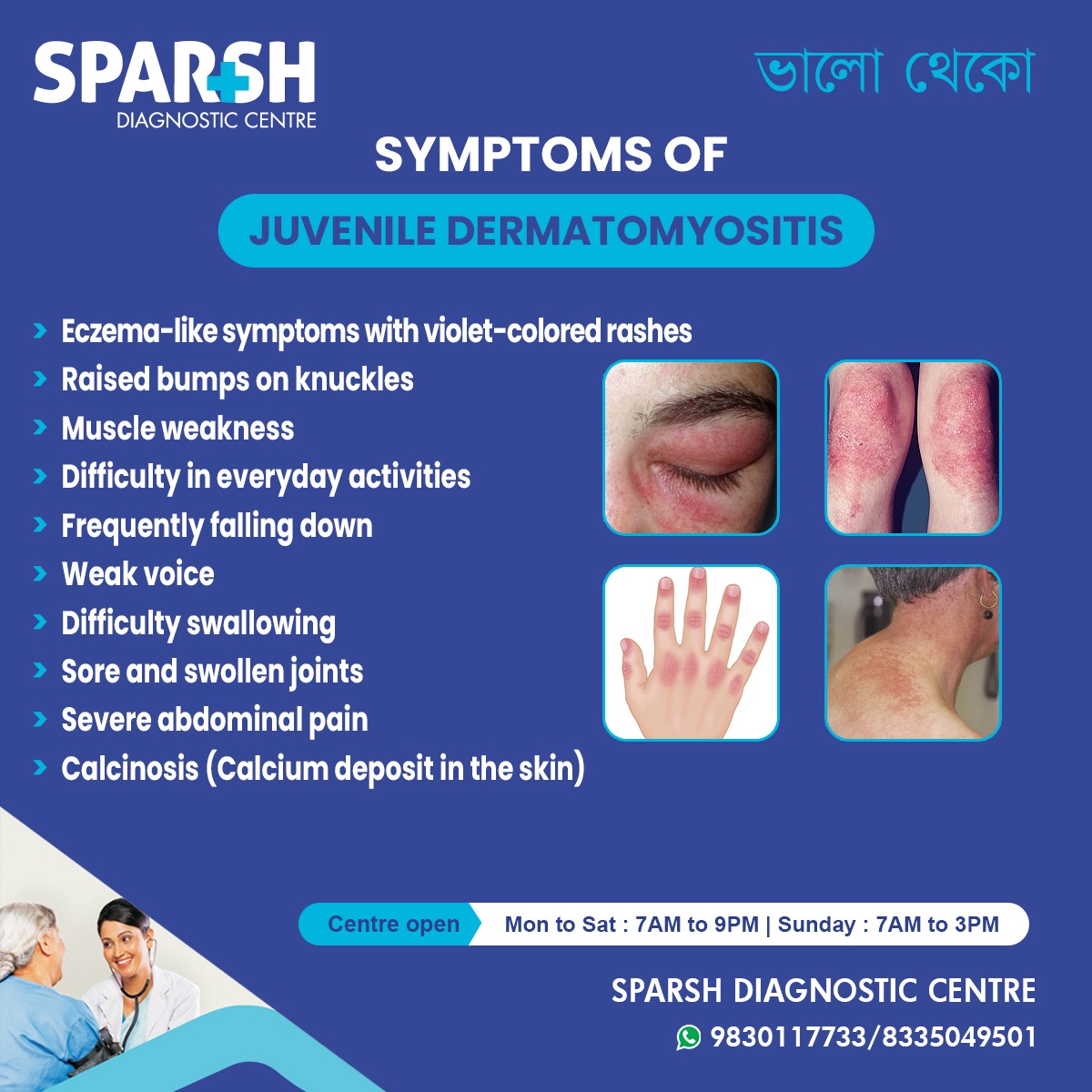Juvenile Dermatomyositis - Sparsh Diagnostic Center