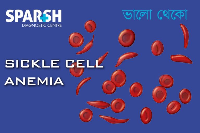 Sickle Cell Anemia - Sparsh Diagnostic Center
