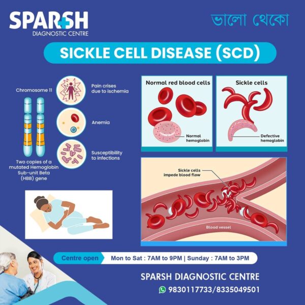 Sickle Cell Disease - Sparsh Diagnostic Center