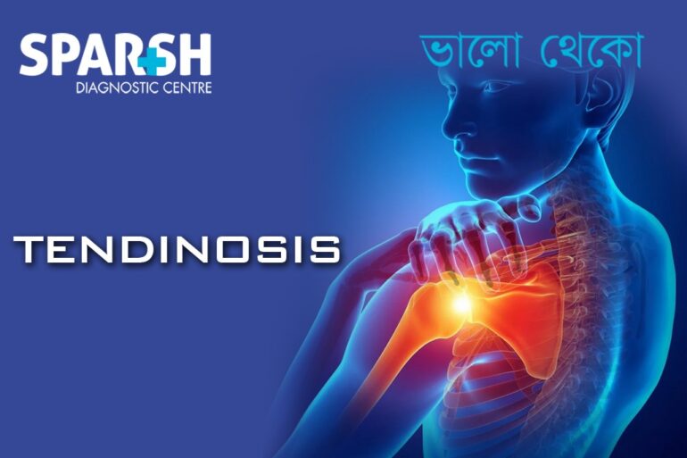 Tendinosis - Sparsh Diagnostic Center