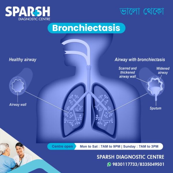 Bronchiectasis - Sparsh Diagnostic Center