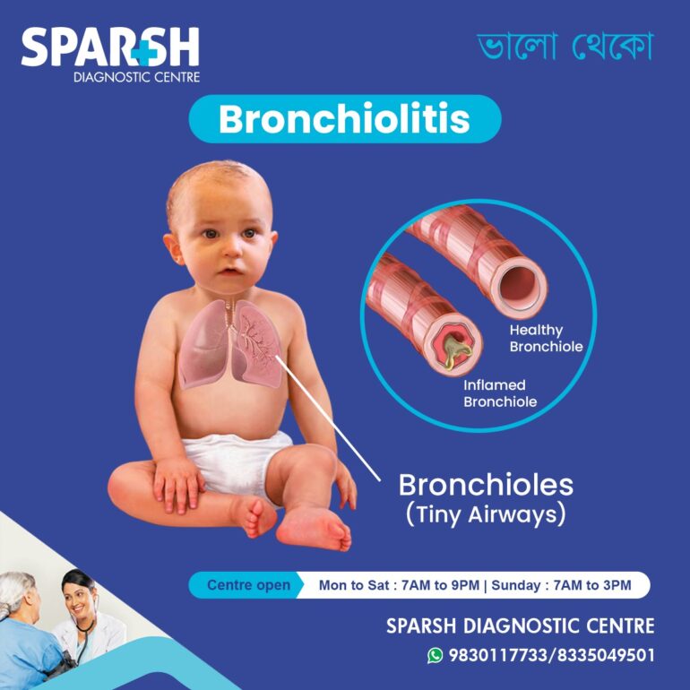 Bronchiolitis - Sparsh Diagnostic Center