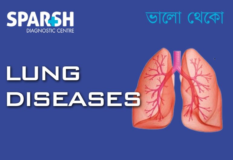 Lung Diseases: Causes, Types, Symptoms, and Treatments - Sparsh ...