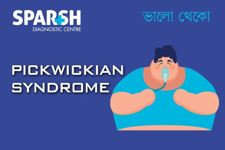 Pickwickian Syndrome - Sparsh Diagnostic Center