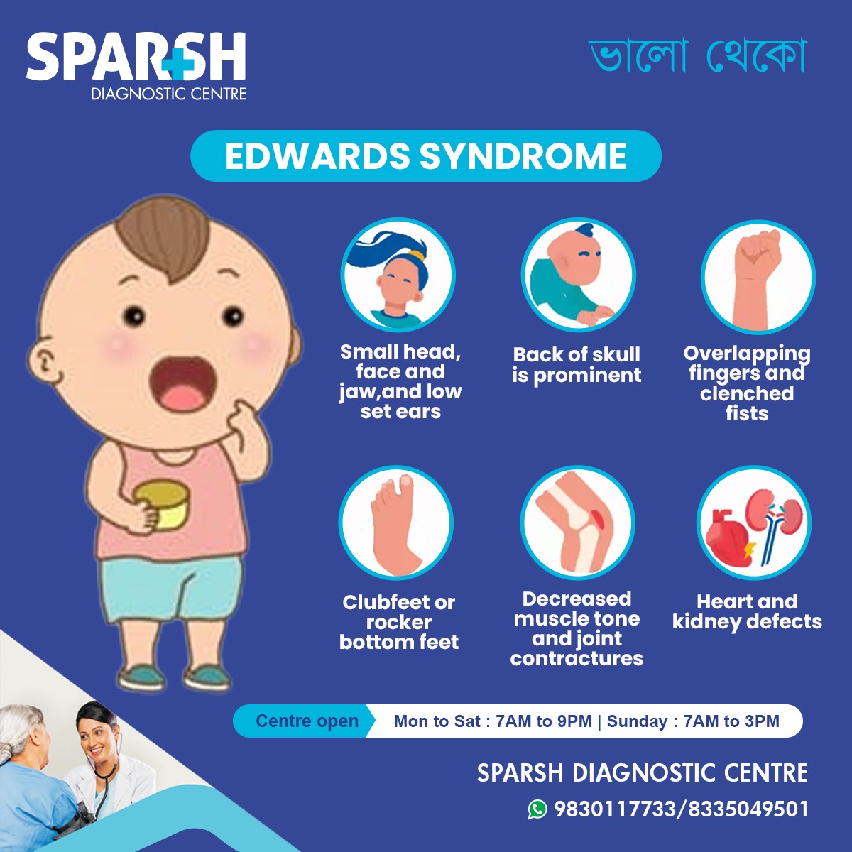 Edwards Syndrome (Trisomy 18) - Sparsh Diagnostic Center