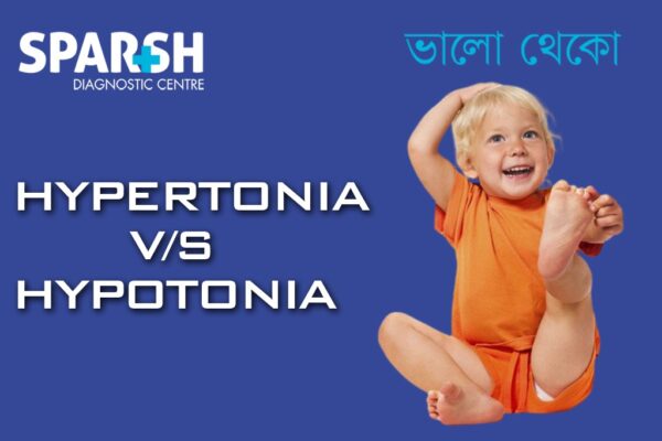 Hypertonia vs Hypotonia - Sparsh Diagnostic Center